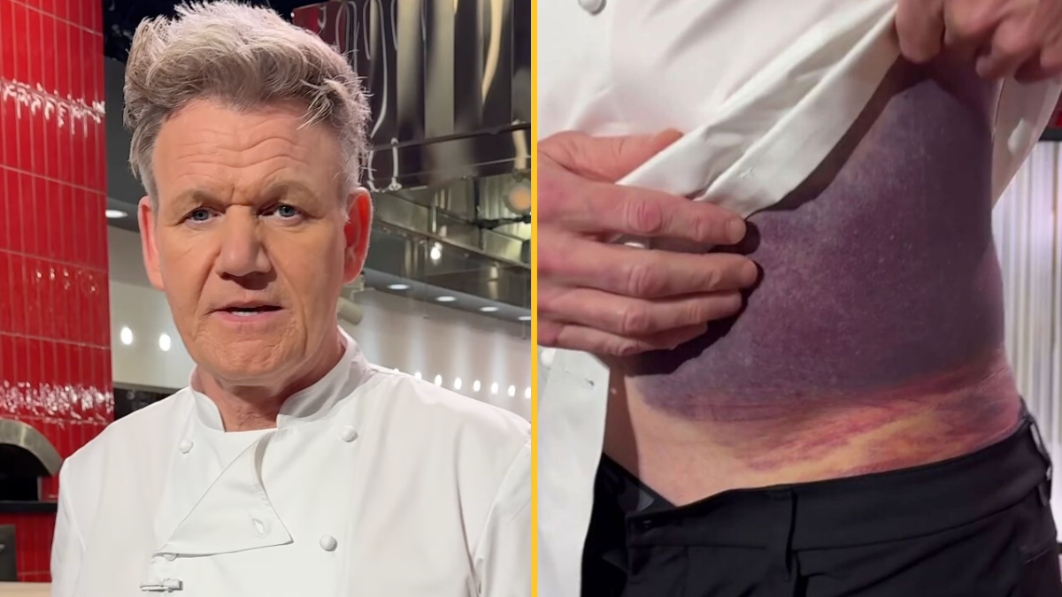 Gordon Ramsay says he's 'lucky to be alive' after serious accident