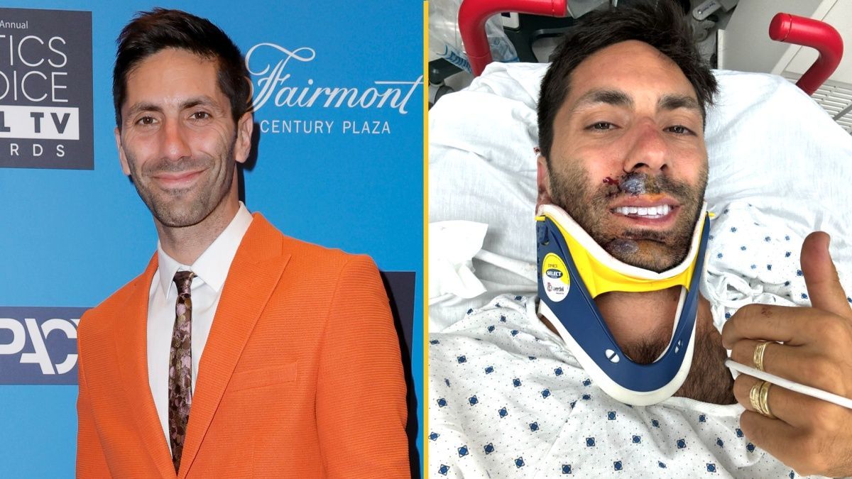 Catfish star Nev Schulman breaks neck in horror crash