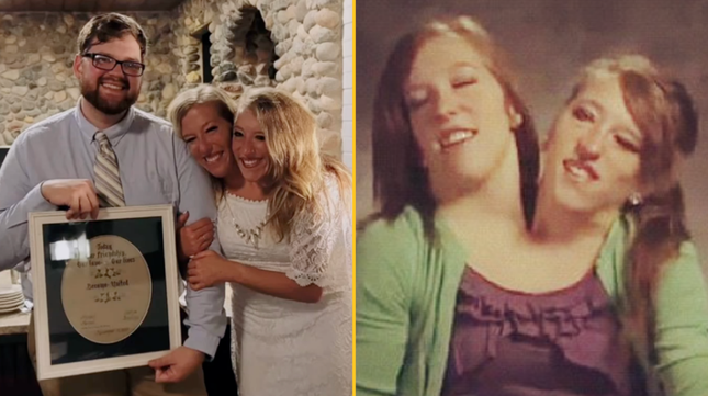 Conjoined twins Abby and Brittany Hensel address photos of them with ...